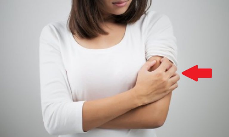 Des Petits Boutons Sur Les Bras? Cela Pourrait Indiquer Une ...
